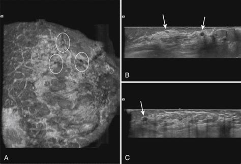 Breast Ultrasound Principles Clinical Tree