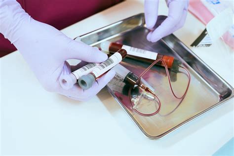 Thrombocytosis Overview And More