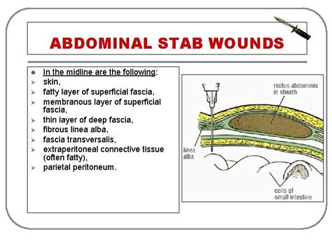 Structure Of The Posterior Abdominal Wall Bony Part