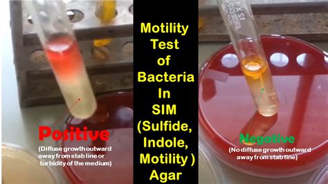Sim Test Microbiology