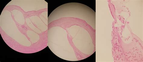 Cochlea Diagram Quizlet