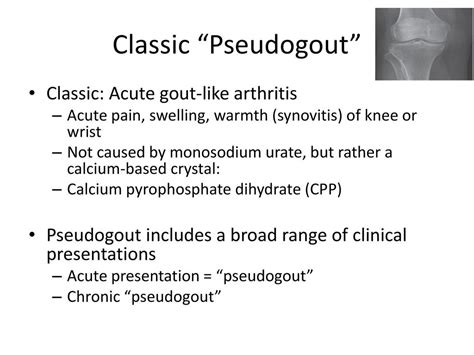 Gout Vs Pseudogout Crystals