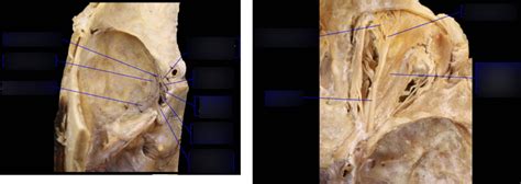 Anatomy Lab 24 Cadaveric Dissection 2 Diagram Quizlet
