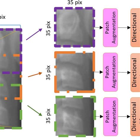 Pdf Classification Of The Cervical Vertebrae Maturation Cvm Stages Using The Tripod Network