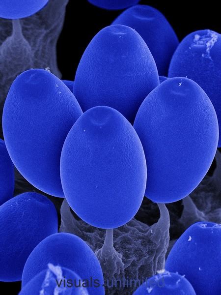 Basidium And Basidiospores Of The Inky Cap Mushroom Coprinus