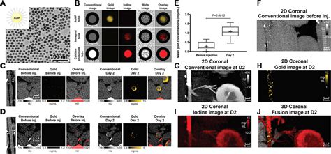 Frontiers Advanced Targeted Nanomedicines For Vulnerable Atherosclerosis Plaque Imaging And