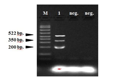 Gel Electrophoresis Of Pcr Products Obtained From Triplex Pcr Assays Download Scientific