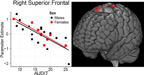 Right Superior Frontal Correlated Negatively With Alcohol Use Disorders
