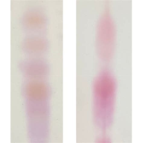 Characterization Of Crude Ips Aqueous Extract Of Sepedonium Sp And Download Scientific Diagram