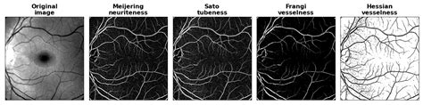 rapids cucim porting scikit image code to the gpu quansight consulting