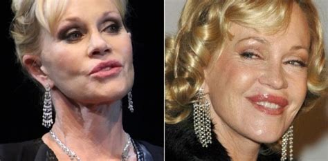Melanie Griffith Before Plastic Surgery People Can See Melanie Griffith