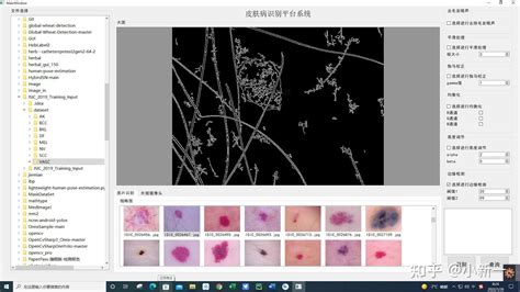 皮肤病识别系统项目使用PyQT 进行界面的搭建 知乎