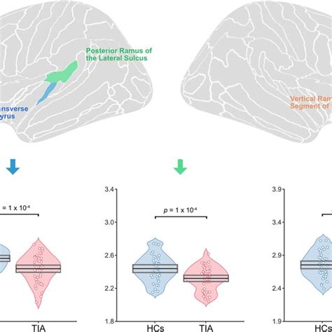 Decreased Nodal Centrality In Transient Ischemic Attack Tia Compared Download Scientific