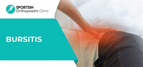 Bursitis Sportsin Orthopaedic Clinic Dr Bernard Lee