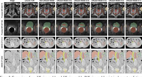 Importance Of Aligning Training Strategy With Evaluation For Diffusion Models In 3d Multiclass