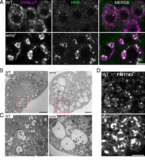 Figure 2 From The Novel Endosomal Membrane Protein Ema Interacts With The Class C Vps Hops