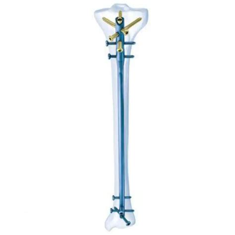 Expert Nailing System™ Titanium Cannulated Tibial Nail Kalteq