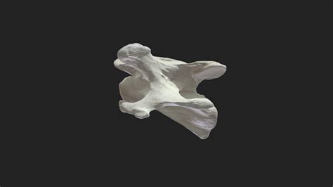 Cervical A 3d Model Collection By Zeynepyalcky Sketchfab