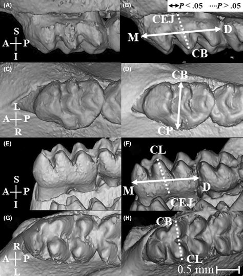 Craniofacial Anomalies In A Murine Model Of Heterozygous Fibroblast Growth Factor 10 Gene