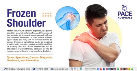 Frozen Shoulder Types Symptoms Causes Diagnosis And Treatment