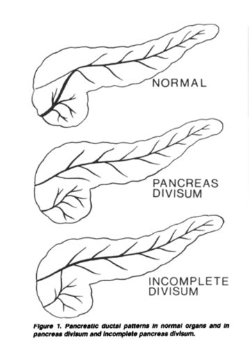 Pancreas Anomalies Flashcards Quizlet