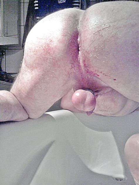 Bdsm Anal Porn Pictures Xxx Photos Sex Images 2117263 Pictoa