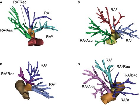 Anatomy Of Pulmonary Artery Establishing Diagnostic Criteria And