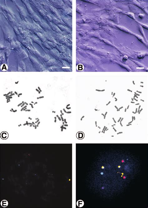 Established Adult Male Fibroblast Cell Lines For Somatic Cell Nuclear