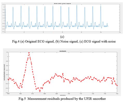 denoising of ecg signal using ufir smoothing with notch filter