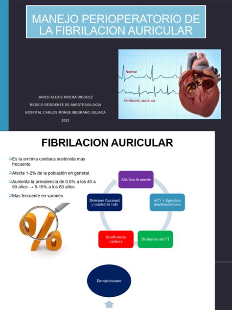 Manejo Perioperatorio De La Fibrilacion Auricular Pdf Medicina Clinica Enfermedades