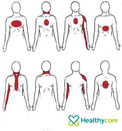 კარდიოლოგია გულის დაავადებების მკურნალობა