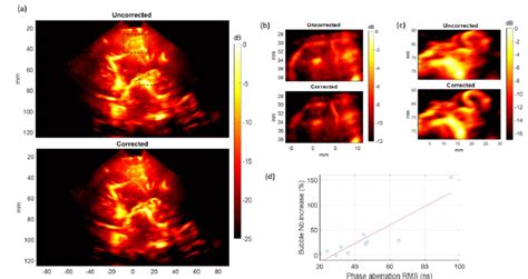 Example Of Transcranial Power Doppler Images Obtained By Ultrafast Download Scientific Diagram