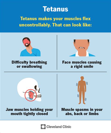 Tetanus Diagnosis