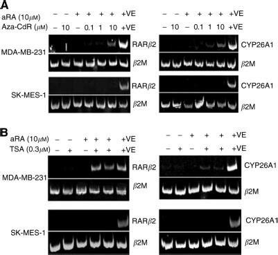 The Effect Of Demethylation And Acetylation On Ara Induced Rarβ2 And