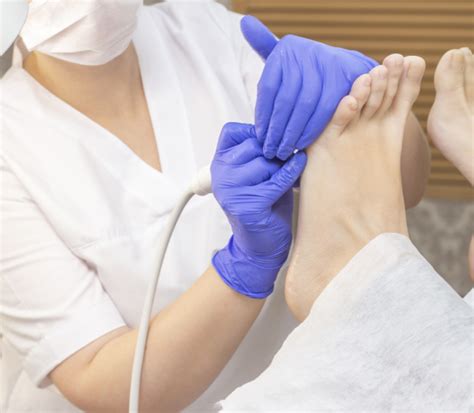 Лечение трещин на пятках в Москве цены на медицинский педикюр отзывы о врачах подологах