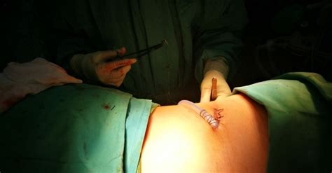 Thoracoscopy Purpose Preparation Procedure Aftercare And Risks