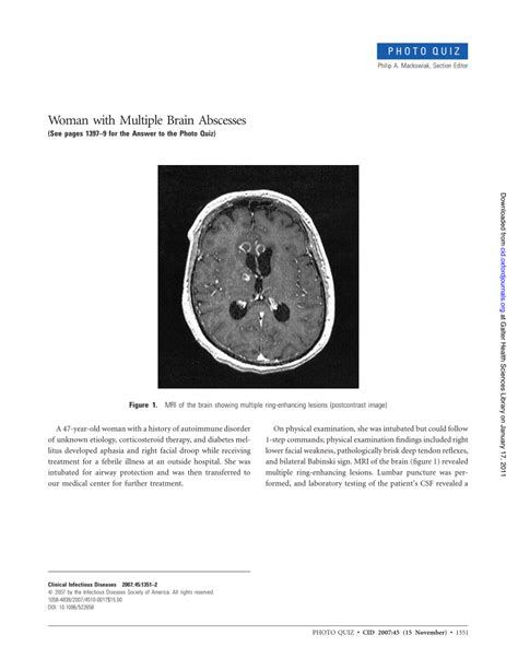 Pdf Woman With Multiple Brain Abscesses