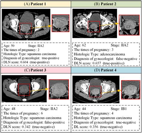 four typical cases to show the performance of deep learning‐based