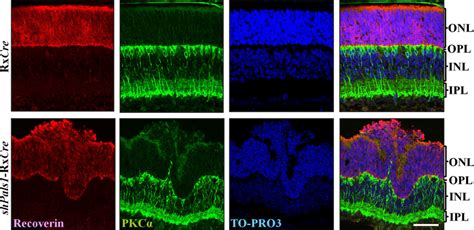 Retinal Cell Specification Is Normal But Cell Patterning Is Aberrant Download Scientific