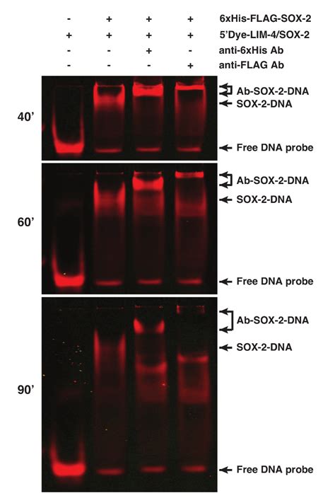 Electrophoretic Mobility Shift Assay Of Tau23dna Electrophoretic