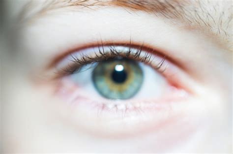 What Is A Refractive Error In The Eyes West Boca Eye Center