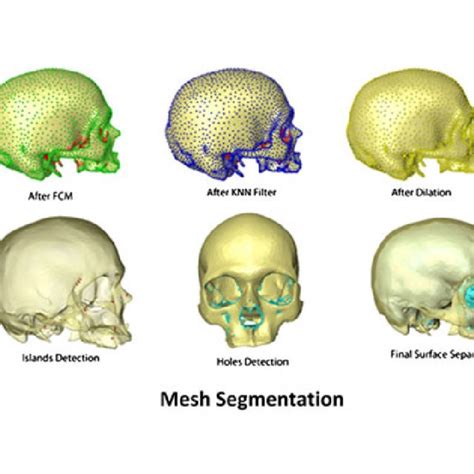 Flow Chart Illustrating The Algorithm For Mesh Segmentation The