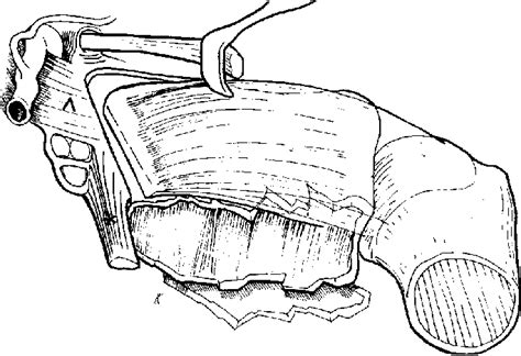 At The Level Of The Distal Radial Metaphysis The Radial Septum Is A Download Scientific Diagram