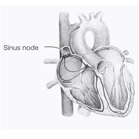 Sinus Node And Atrial Depolarization Eko