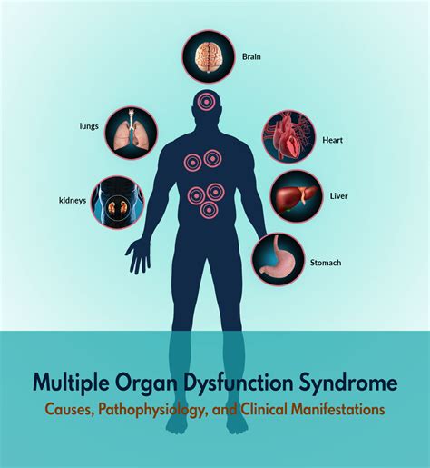 multiple organ dysfunction syndrome causes pathophysiology and