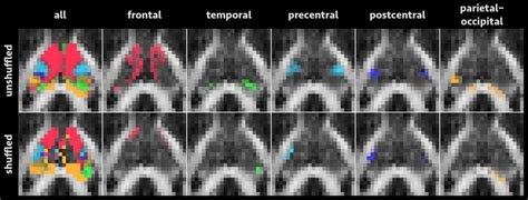 Use Of Transparency To Show The Degree Of Confidence In Each Voxel Download Scientific Diagram