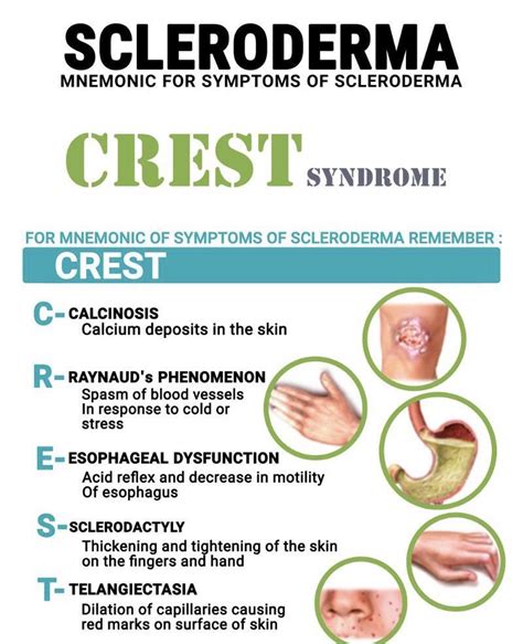 Scleroderma Crest Medizzy
