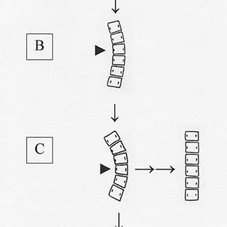 PDF The Transformation Of Spinal Curvature Into Spinal Deformity Pathological Processes And
