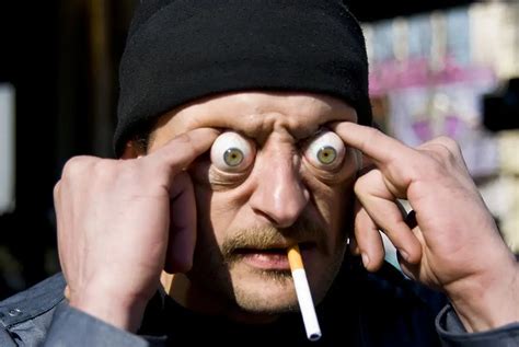 Eyes Get Out Of Their Sockets Bulging Eyes Exophthalmos Or A