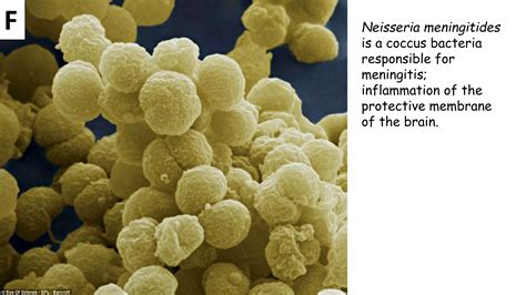 Bacteria Disease Examples Pptx